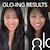 GLO Lit™ At-Home Teeth Whitening Device Kit - GLO Science | Sephora