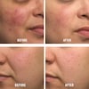 Mini Ultra Repair® Cream Intense Hydration - First Aid Beauty | Sephora