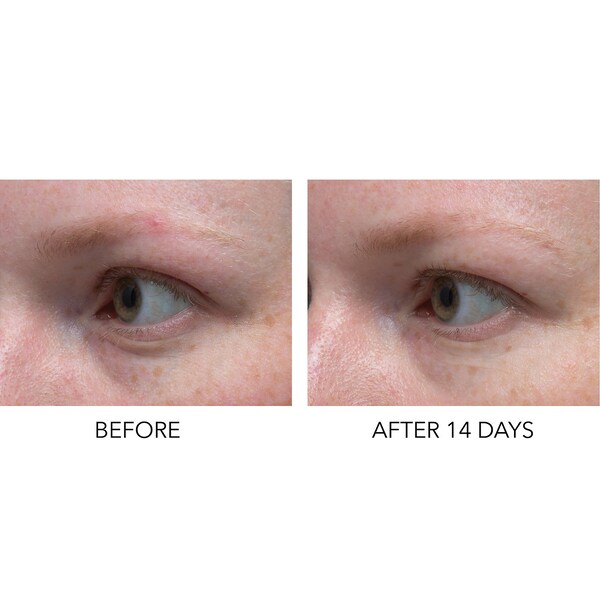 Hyaluronic Marine Dew It Right Eye Gel - Dr. Dennis Gross Skincare ...
