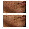 DRx SpectraLite™ FaceWare Pro - Dr. Dennis Gross Skincare | Sephora
