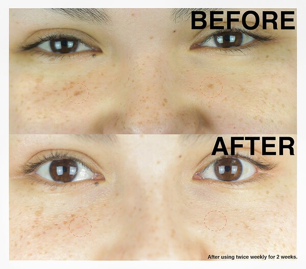 Microneedling Dark Spot Brightening Dots - Peace Out | Sephora
