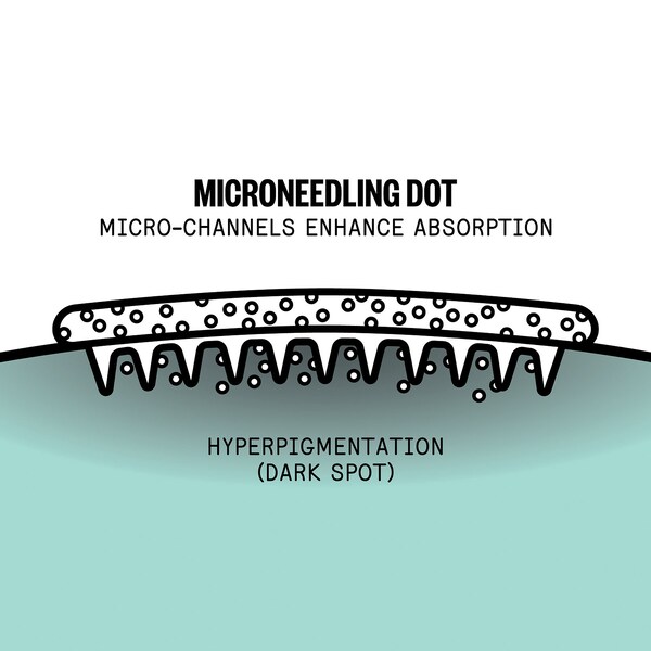 Microneedling Dark Spot Brightening Dots - Peace Out | Sephora