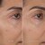 Liquid Gold Firming Eye Cream - Alpha-H | Sephora