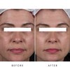 Liquid Gold Ultimate Perfecting Mask with Glycolic, Ferulic and Lactic ...