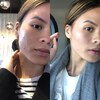 ClearCalm Non-Drying Acne Treatment Gel - REN Clean Skincare | Sephora