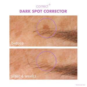 Correct+™ Dark Spot Corrector - Skinfix | Sephora
