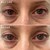 Cheer Up Brightening Vitamin C Eye Cream with Acerola Cherry - Farmacy ...