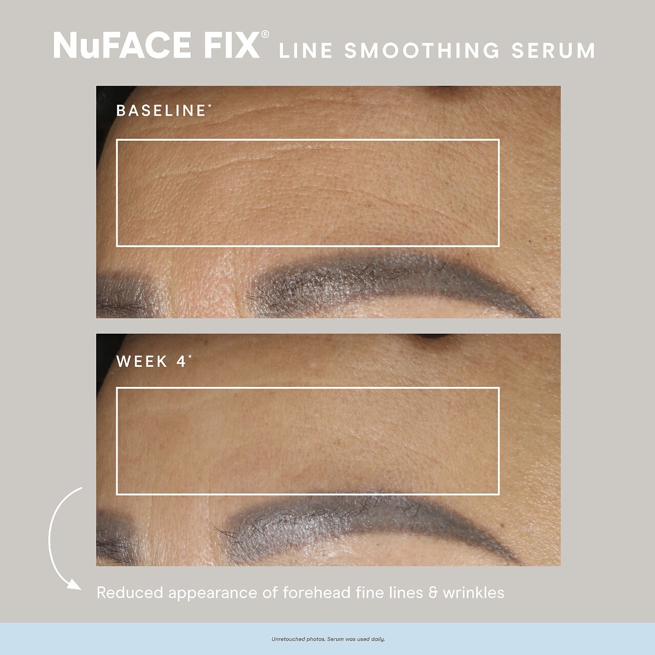 NuFACE FIX® Line Smoothing Device | Hamilton Place