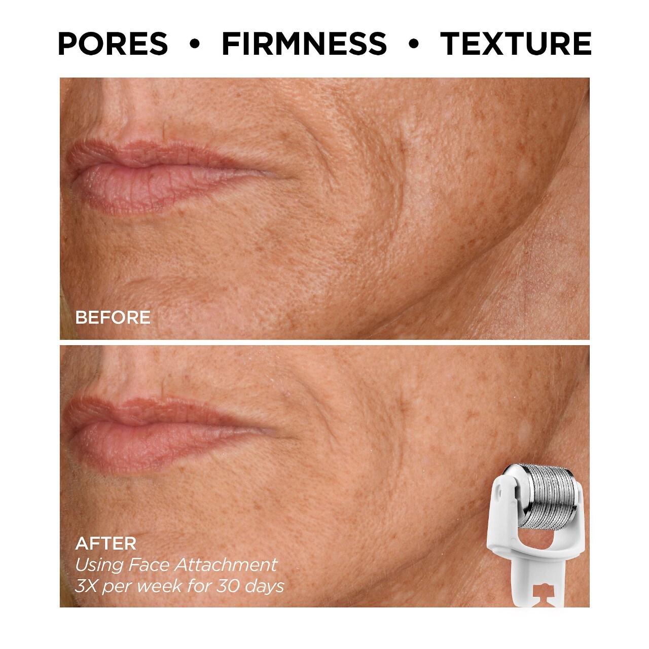 BeautyBio The Complete Glo Set | Mall of America®