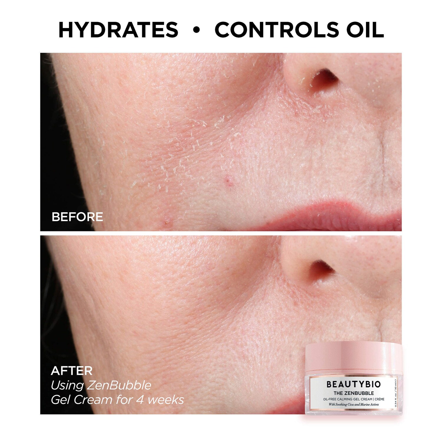 BeautyBio The Complete Glo Set | Mall of America®