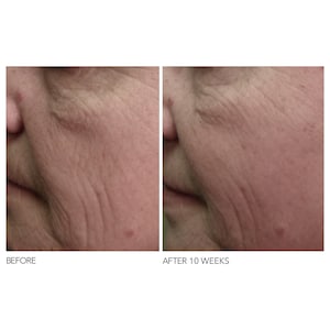 DRx SpectraLite™ FaceWare Pro - Dr. Dennis Gross Skincare | Sephora