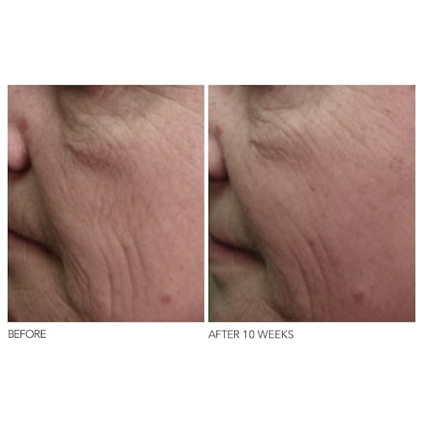 DRx SpectraLite™ FaceWare Pro - Dr. Dennis Gross Skincare | Sephora