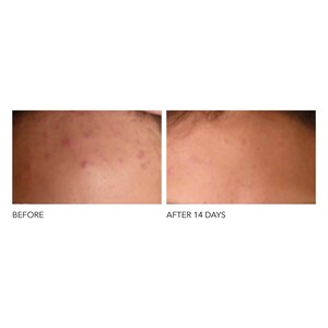 DRx SpectraLite™ FaceWare Pro - Dr. Dennis Gross Skincare | Sephora