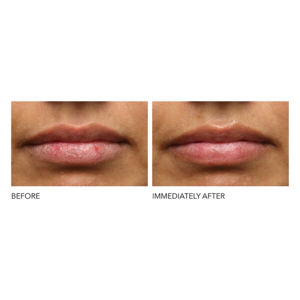 Hyaluronic Marine Collagen Lip Cushion - Dr. Dennis Gross Skincare ...