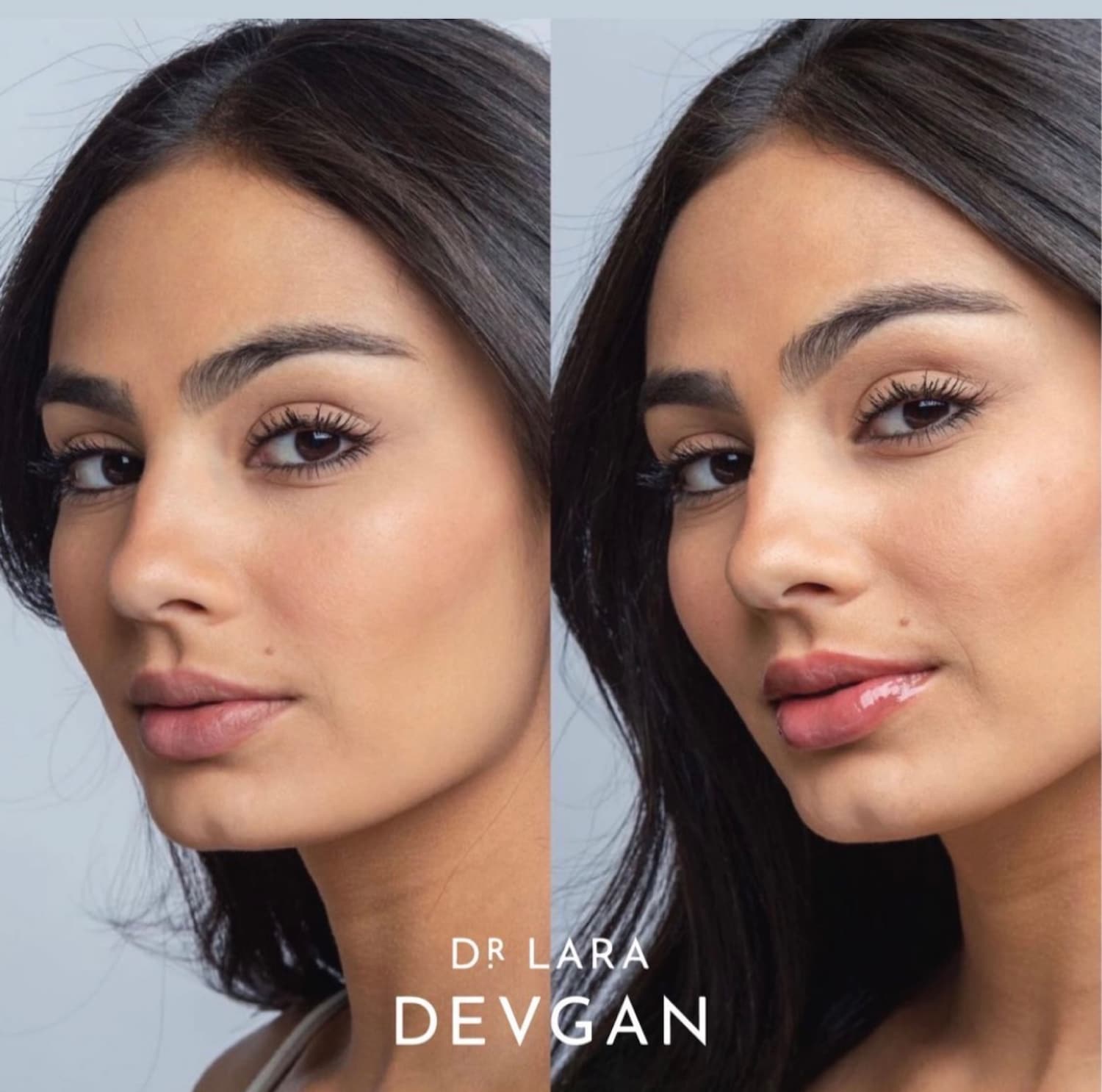 Dr. Lara Devgan Scientific Beauty Platinum Lip Plump SPF 30 | Mall of ...