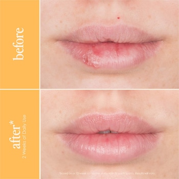 Collagen Lips Mask Review | Lipstutorial.org