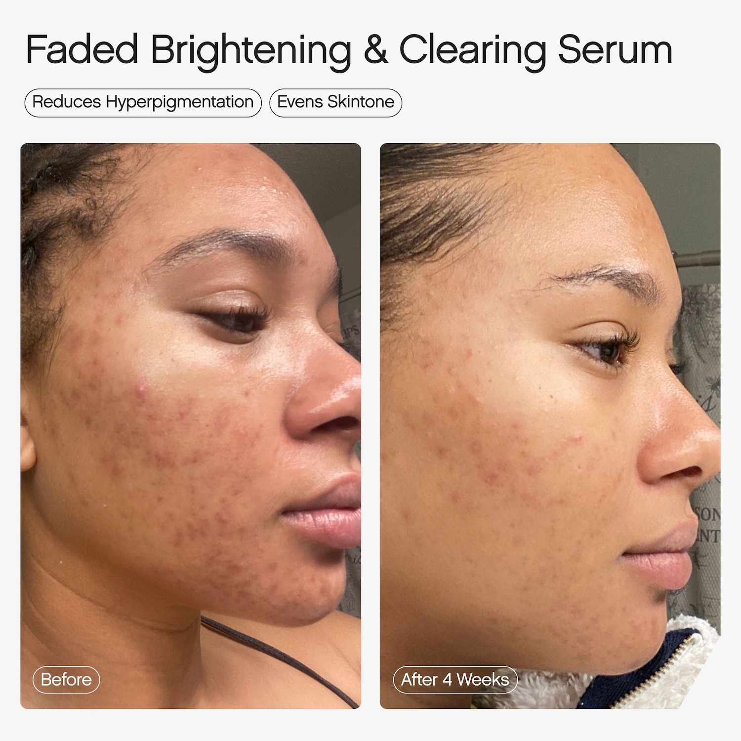 Topicals Faded Serum For Dark Spots & Discoloration - Big Apple Buddy