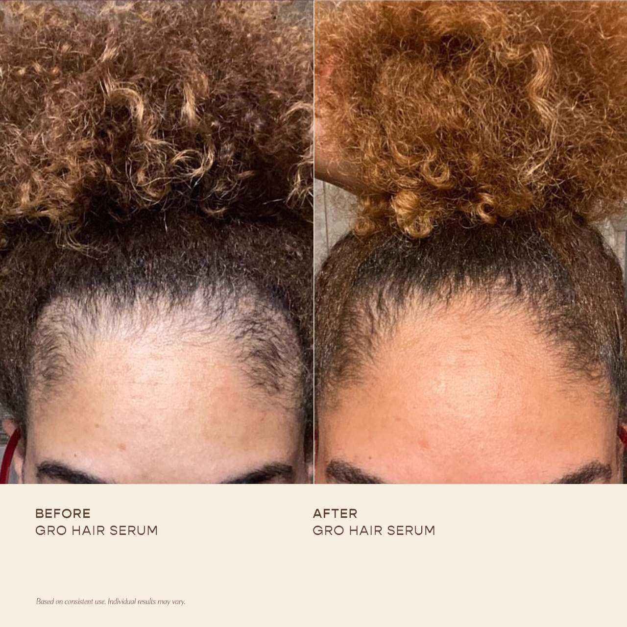 Vegamour GRO Hair Serum for Thinning | Hamilton Place