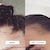 Intensive Leave-In Scalp Spray Treatment for Thinning Hair - BondiBoost ...