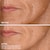 Get That Glow - GloPRO® Facial Microneedling Discovery Set - BeautyBio ...