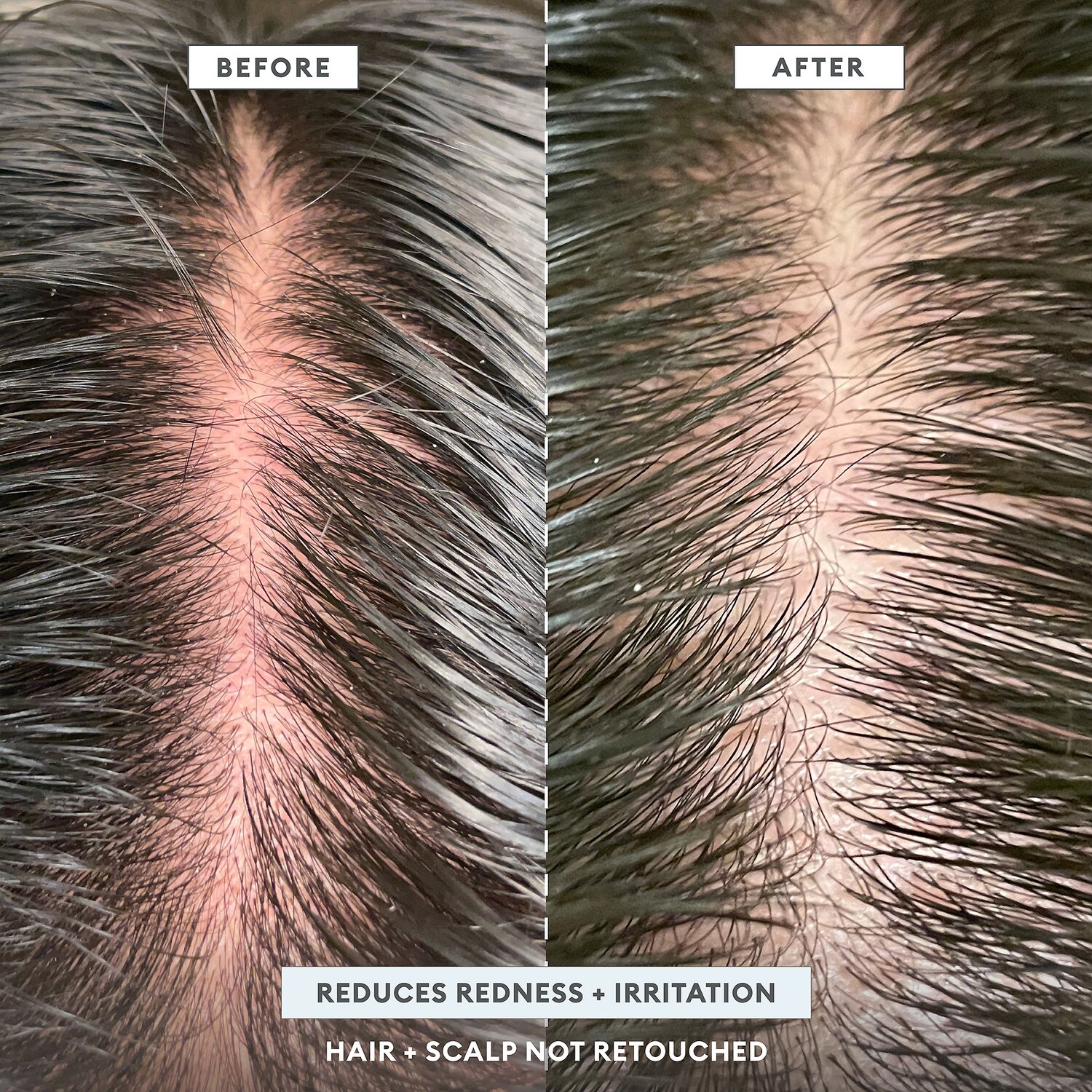 Briogeo Scalp Revival™ Dandruff Relief Charcoal Shampoo | Mall of America®