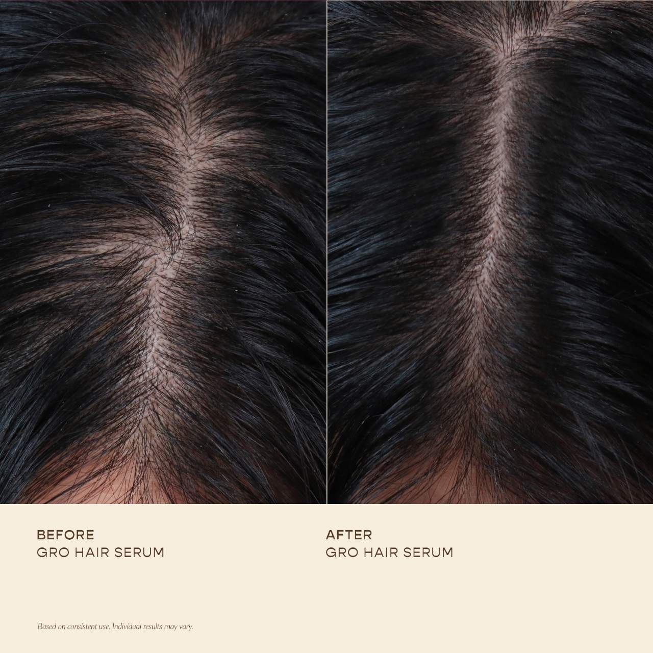 Vegamour GRO Hair Serum Trio Set for Thinning Hair | Mall of America®