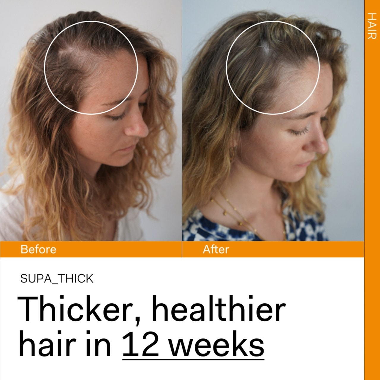 Thicker Hair Before After