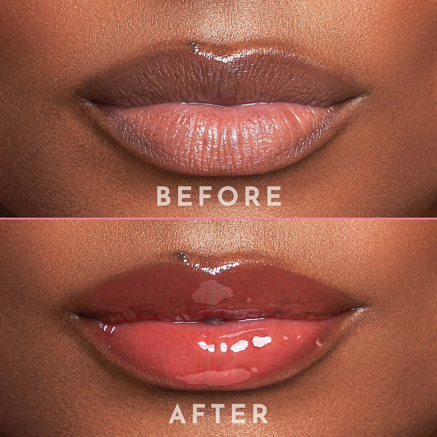 Lip-filler | Mall of America®