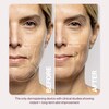 LUXE+ Advanced Sonic Dermaplaning + Peach Fuzz Removal - DERMAFLASH ...