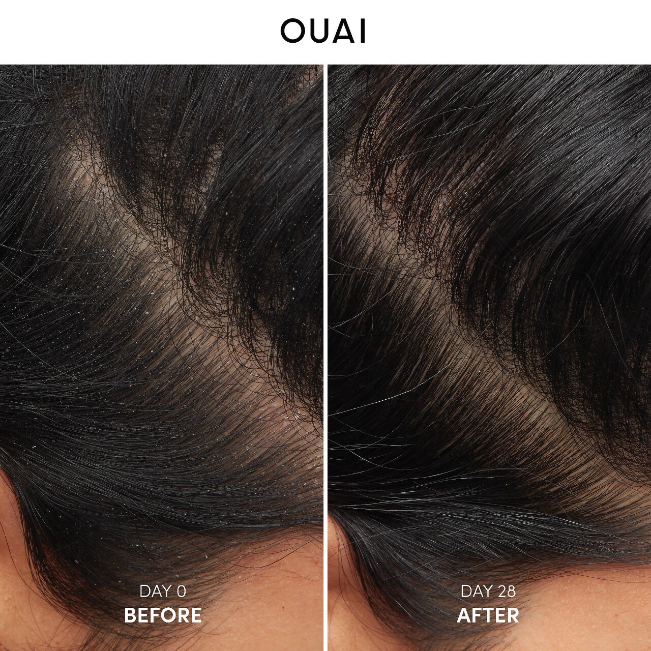 OUAI Anti-Dandruff Shampoo | Hamilton Place