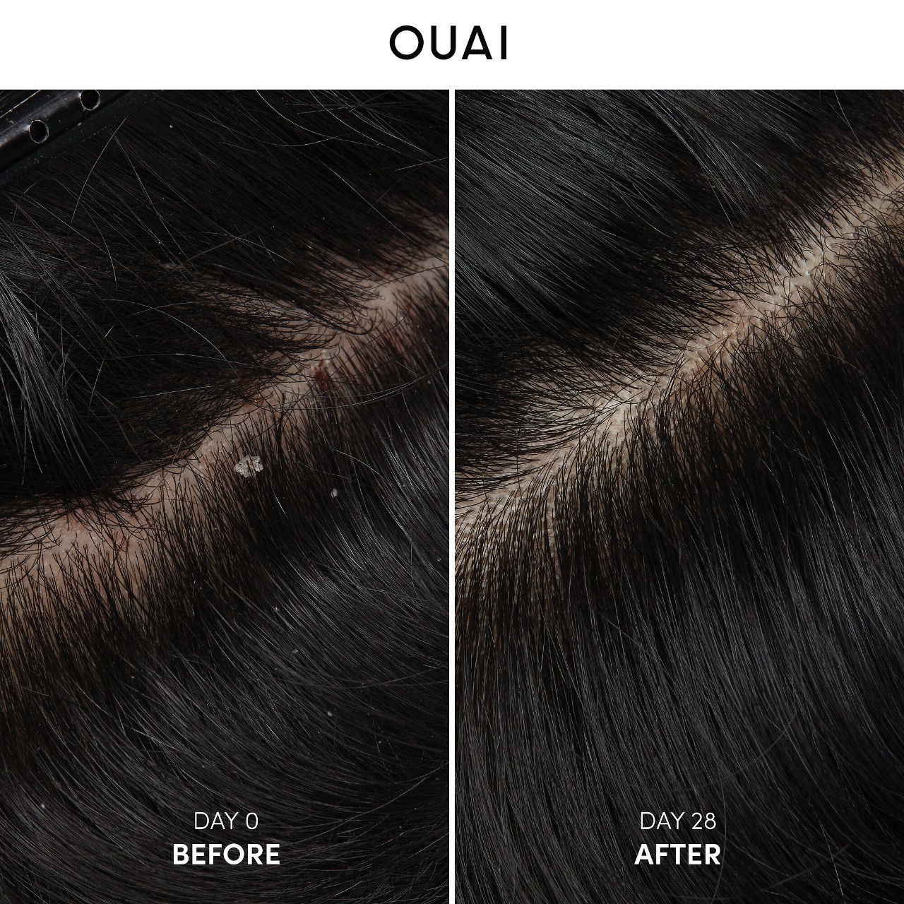 OUAI Anti-Dandruff Shampoo | Hamilton Place
