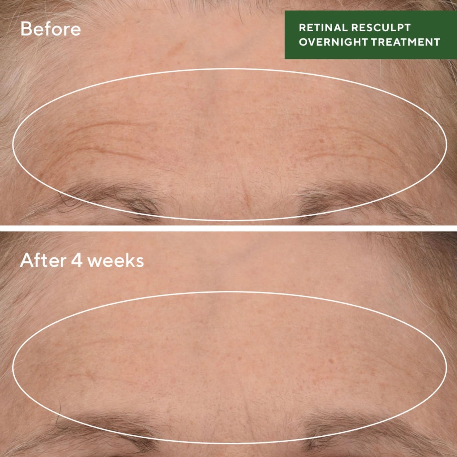 Murad Retinal ReSculpt Overnight Treatment | CoolSprings Galleria