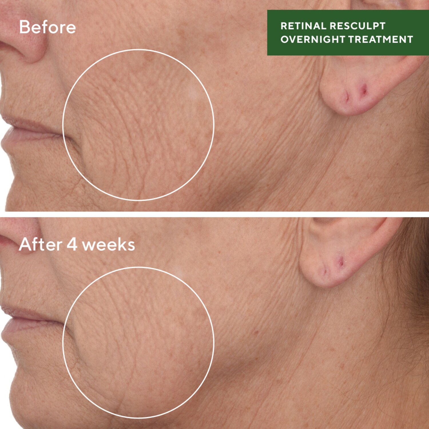 Murad Retinal ReSculpt Overnight Treatment | Hamilton Place