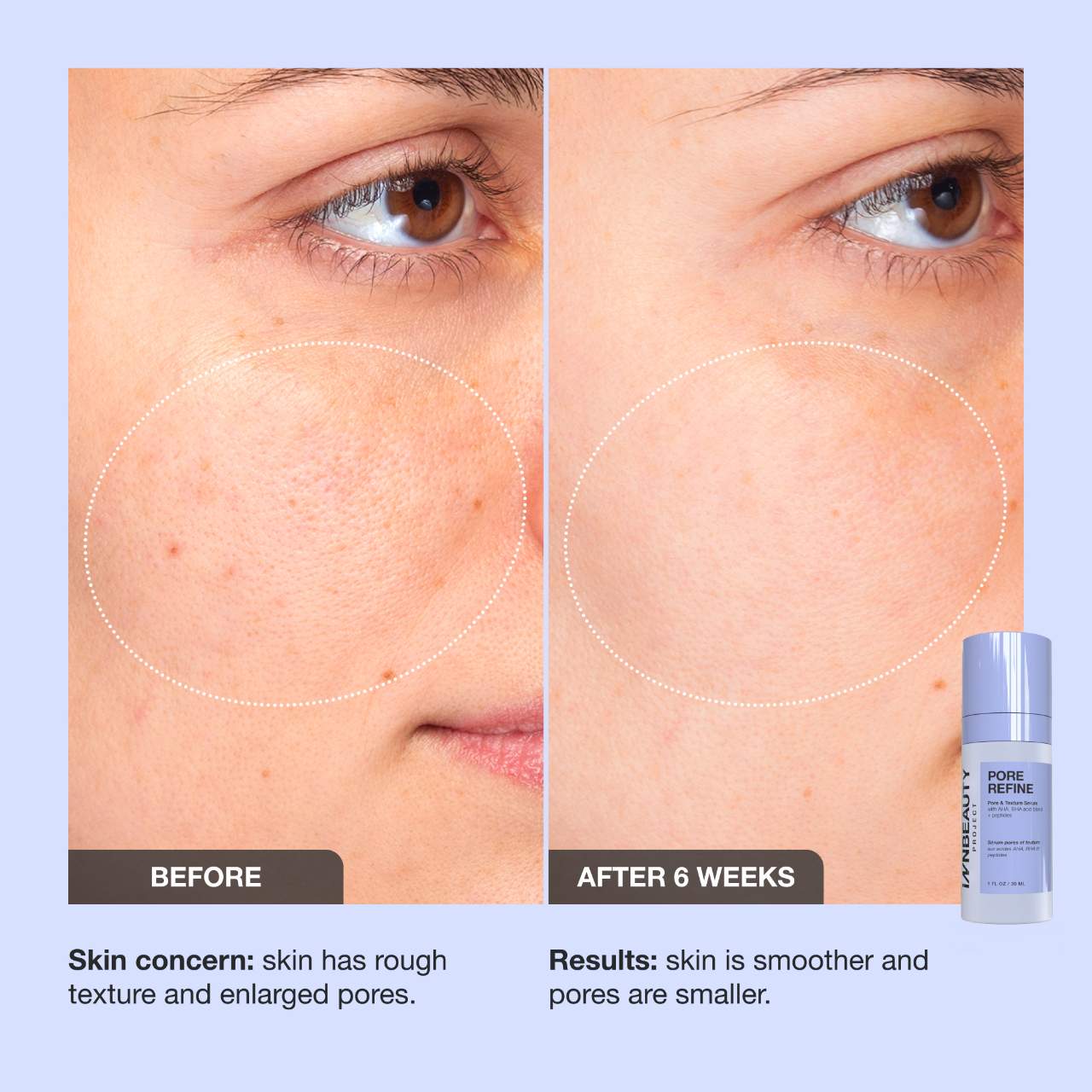 Innbeauty Project Pore Refine Pore Shrinking & Texture Smoothing Serum ...