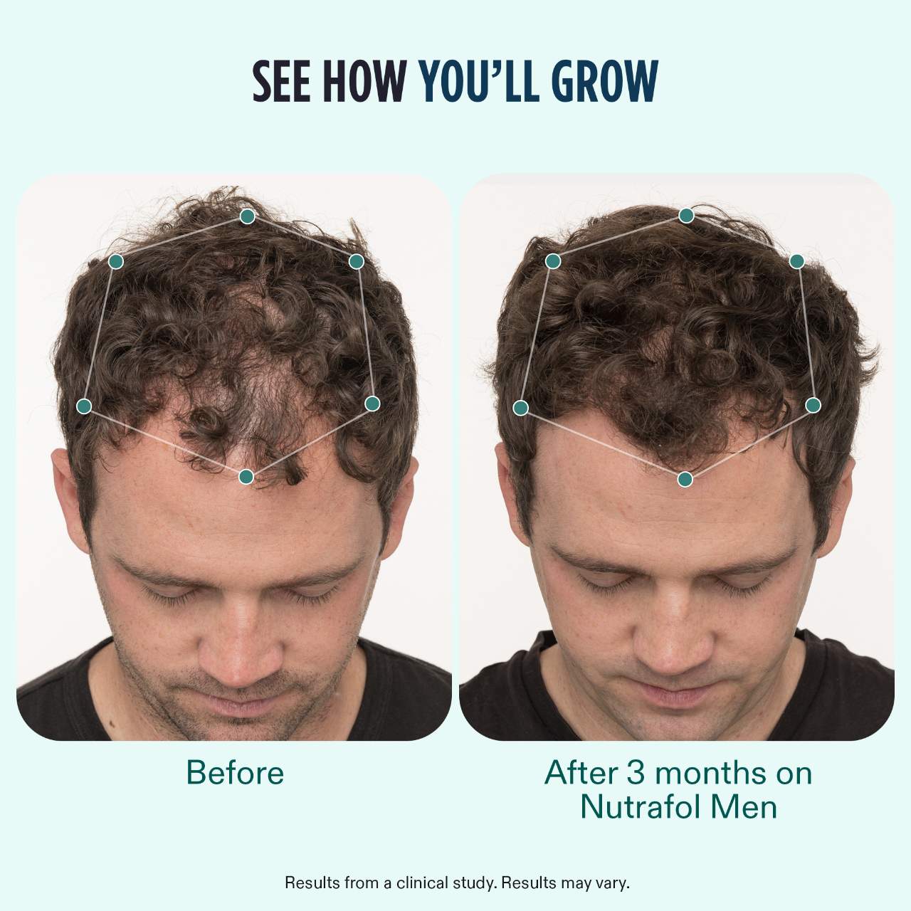 Nutrafol MEN Clinically Proven Hair Growth Supplement for Thinning ...