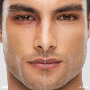 Men Concealer Before And After