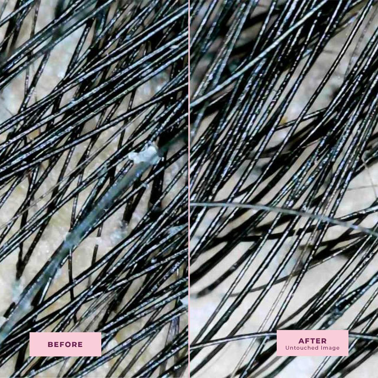 SHAZ & KIKS Rice + Chai Scalp Refresh Spray for Healthy, Hydrated Scalp ...