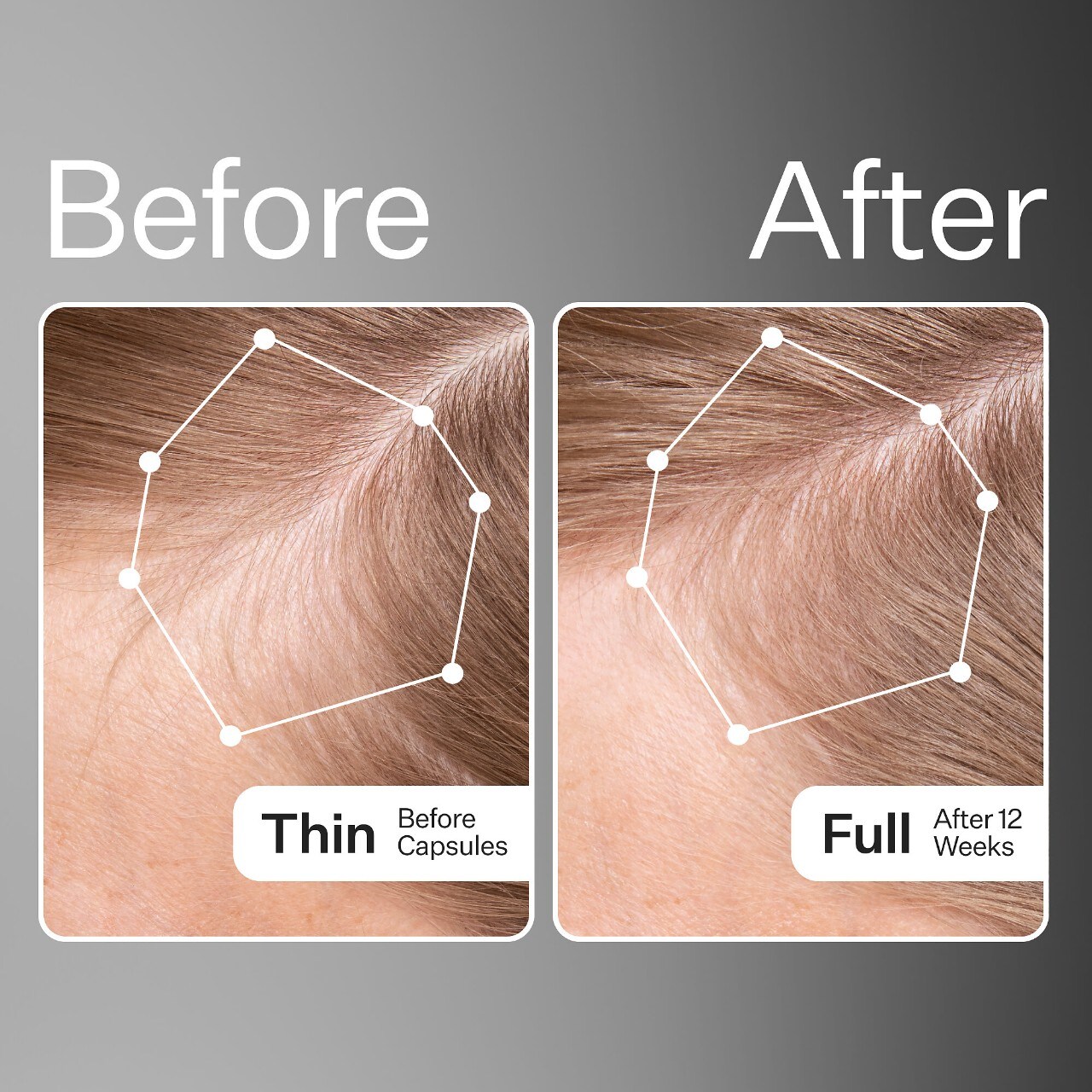 Act+Acre Thick + Full Hair Capsules For Hair Growth - Big Apple Buddy