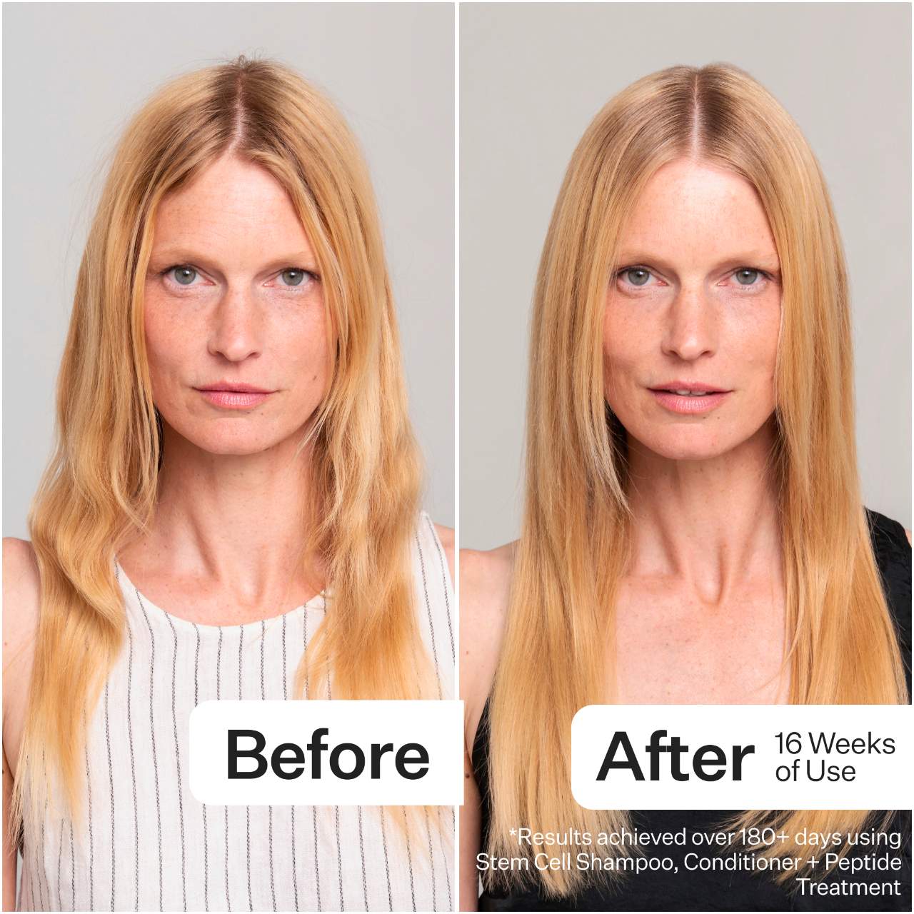 Act+Acre Stem Cell Stimulating Conditioner For Hair Thinning & Growth ...