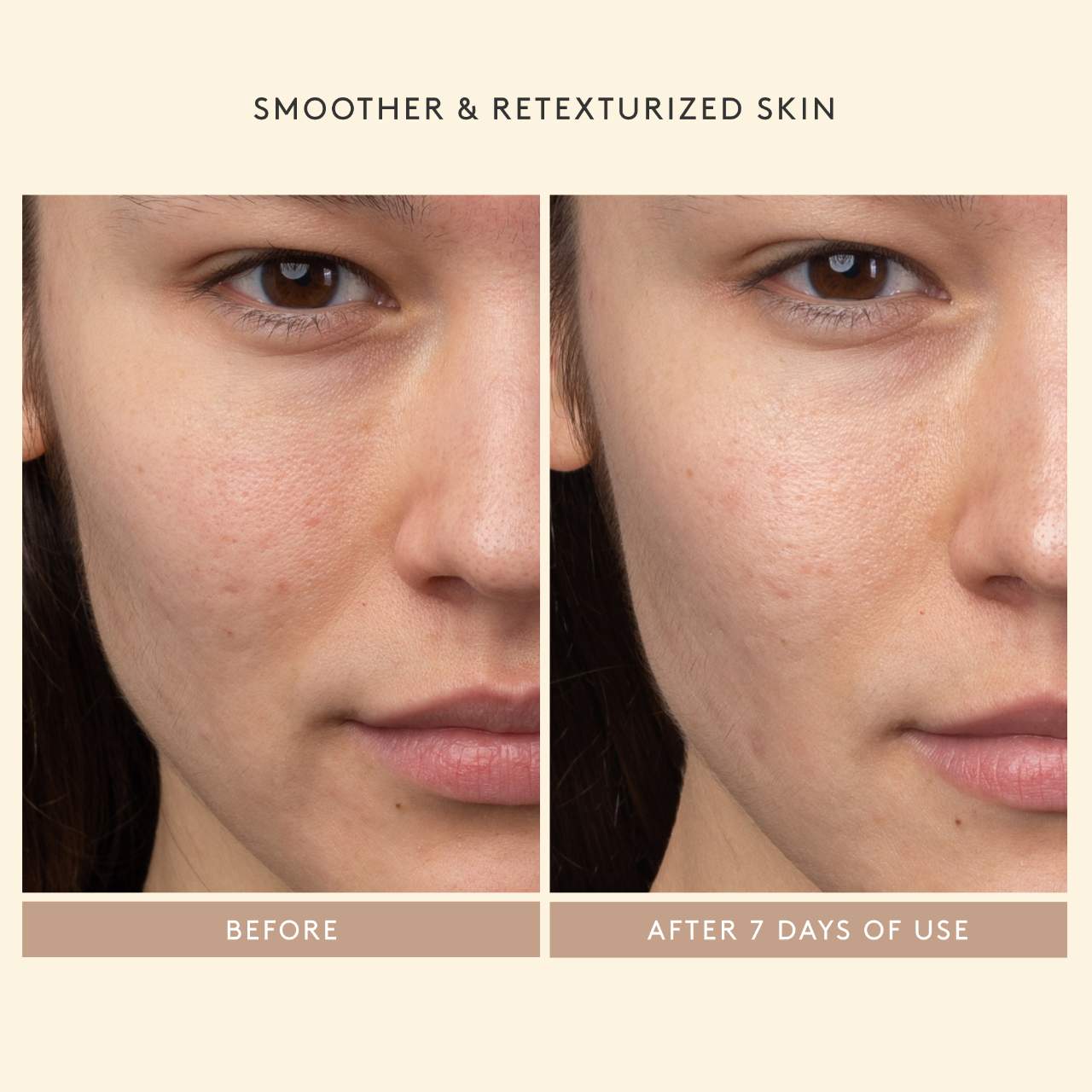 Shani Darden Skin Care Lactic Acid AHA Exfoliating Serum | Hamilton Place
