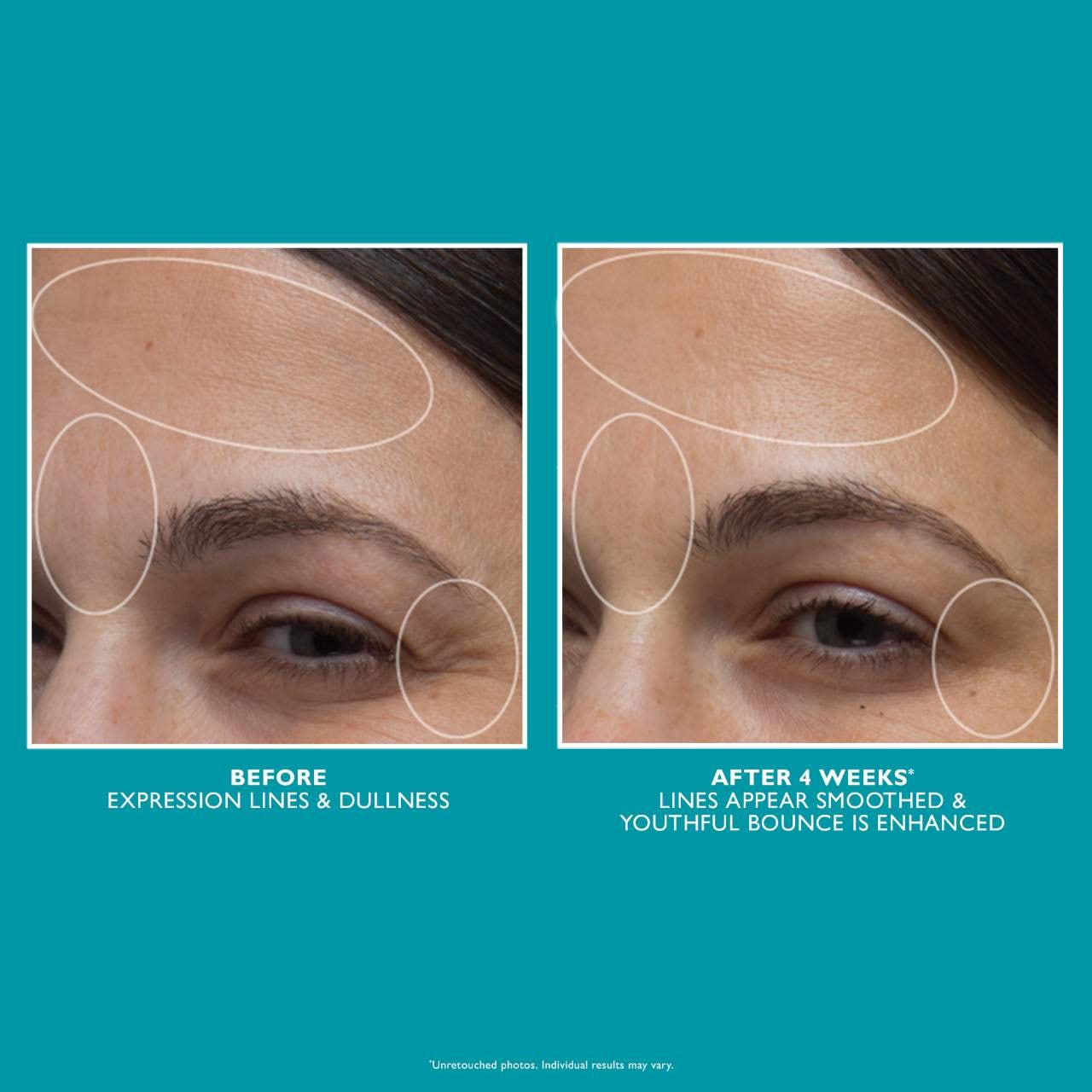 Peter Thomas Roth Peptide Skinjection™ Moisture Infusion Refillable ...