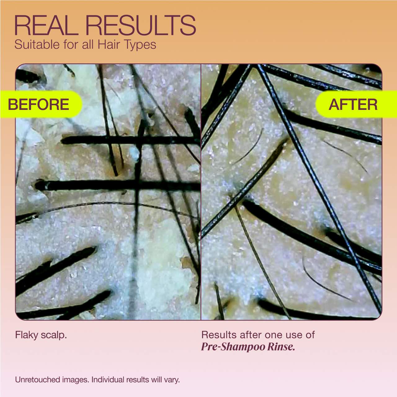 The Rootist Aha+Acv Pre-Shampoo Scalp Clarifying Treatment - Big Apple ...