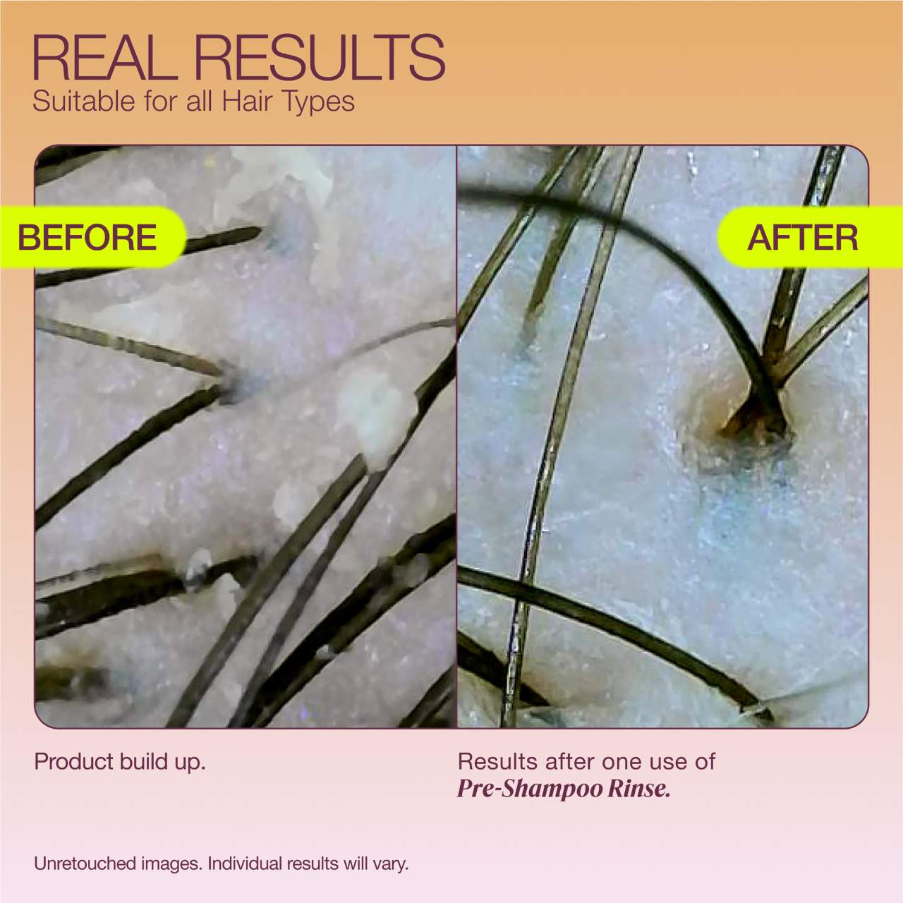 The Rootist Aha+Acv Pre-Shampoo Scalp Clarifying Treatment - Big Apple ...