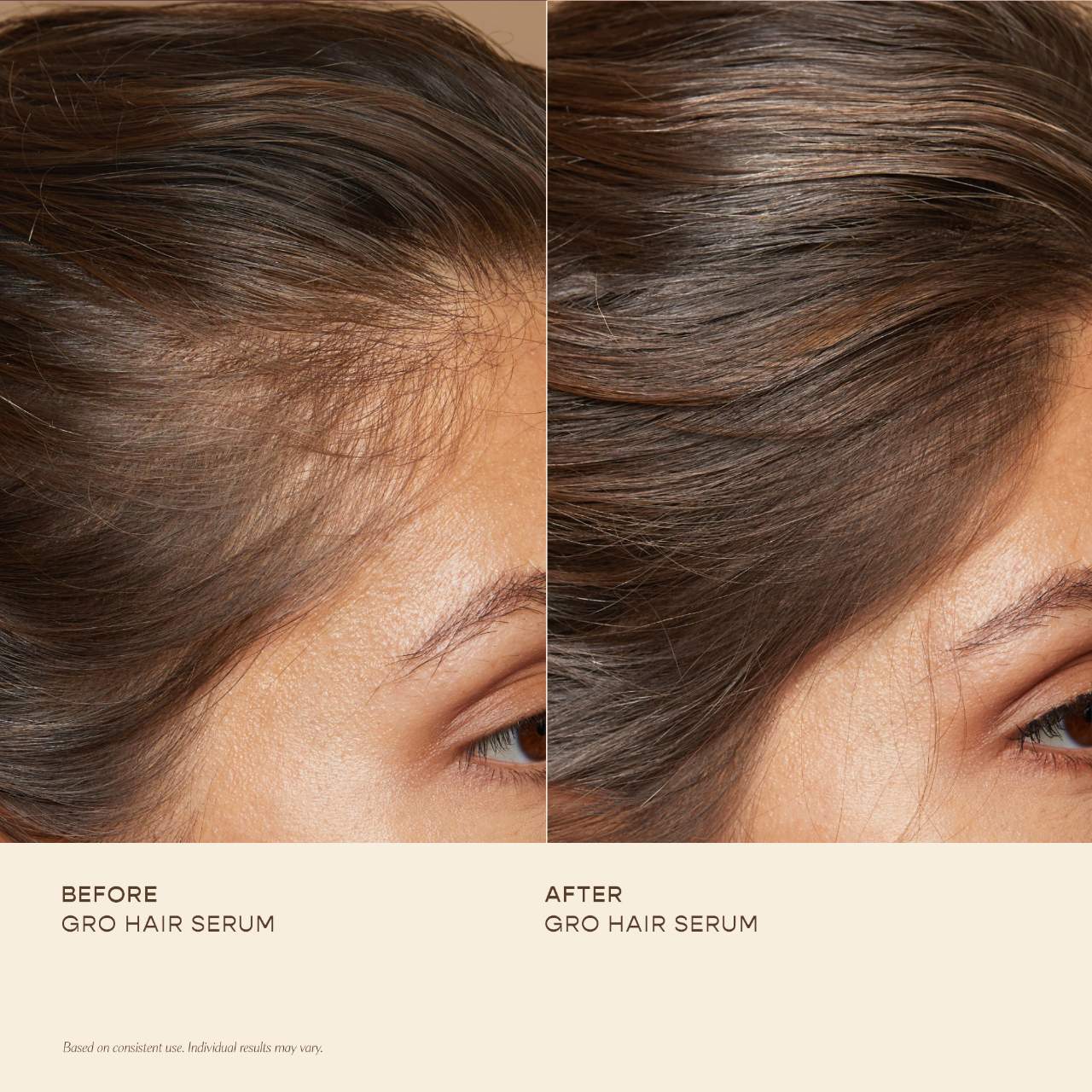 Vegamour GRO Healthy Hair Starter Set | Mall of America®