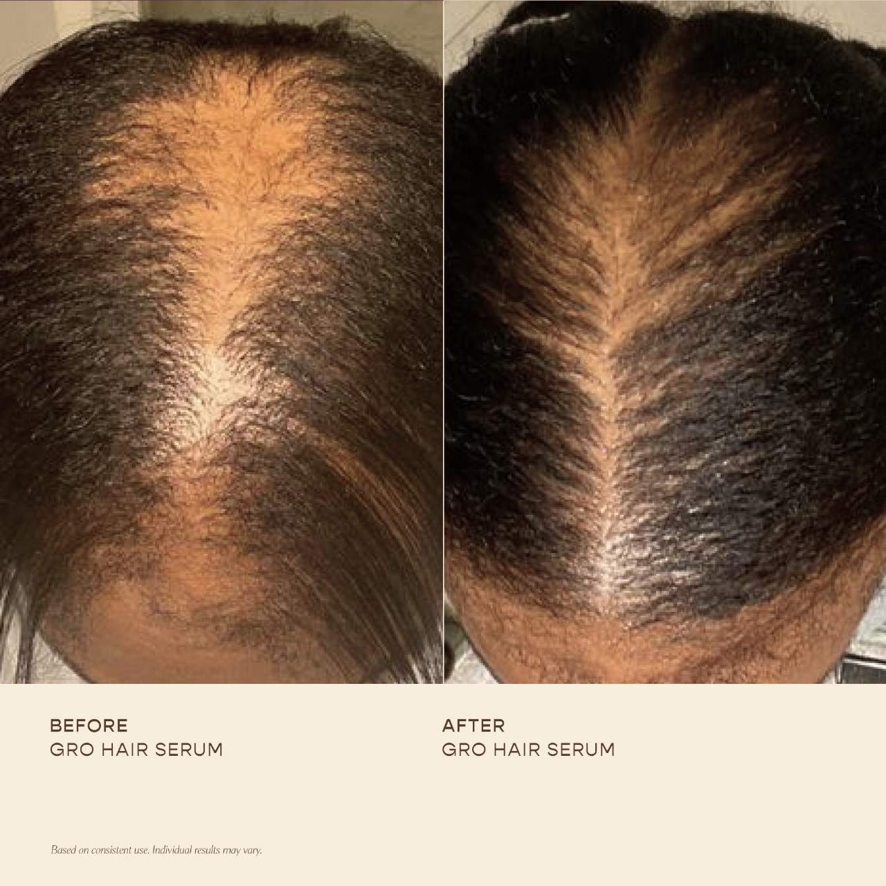 Vegamour GRO Healthy Hair Starter Set | Mall of America®