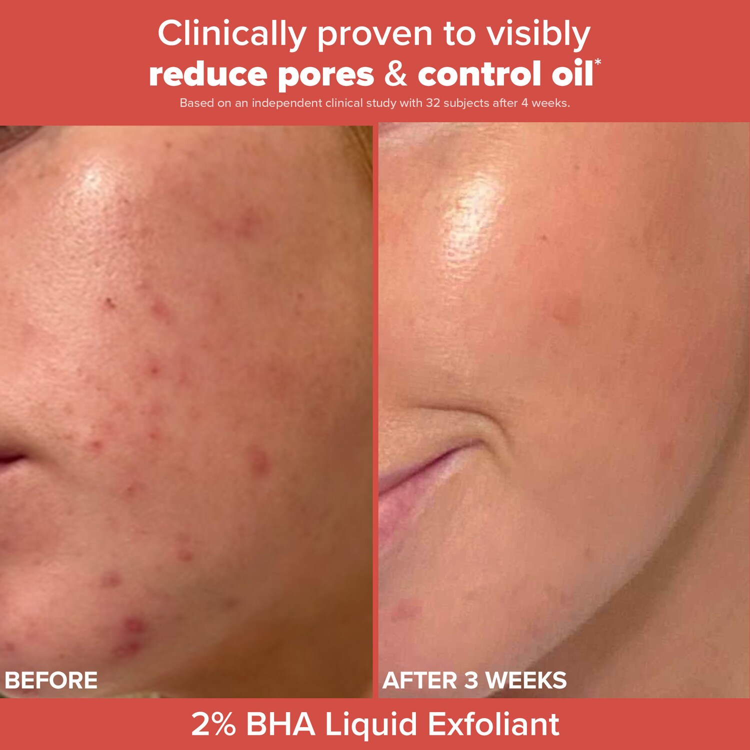 Paula's Choice 7 Days Of Glow Advent Calendar With 2% Bha, Peptide ...