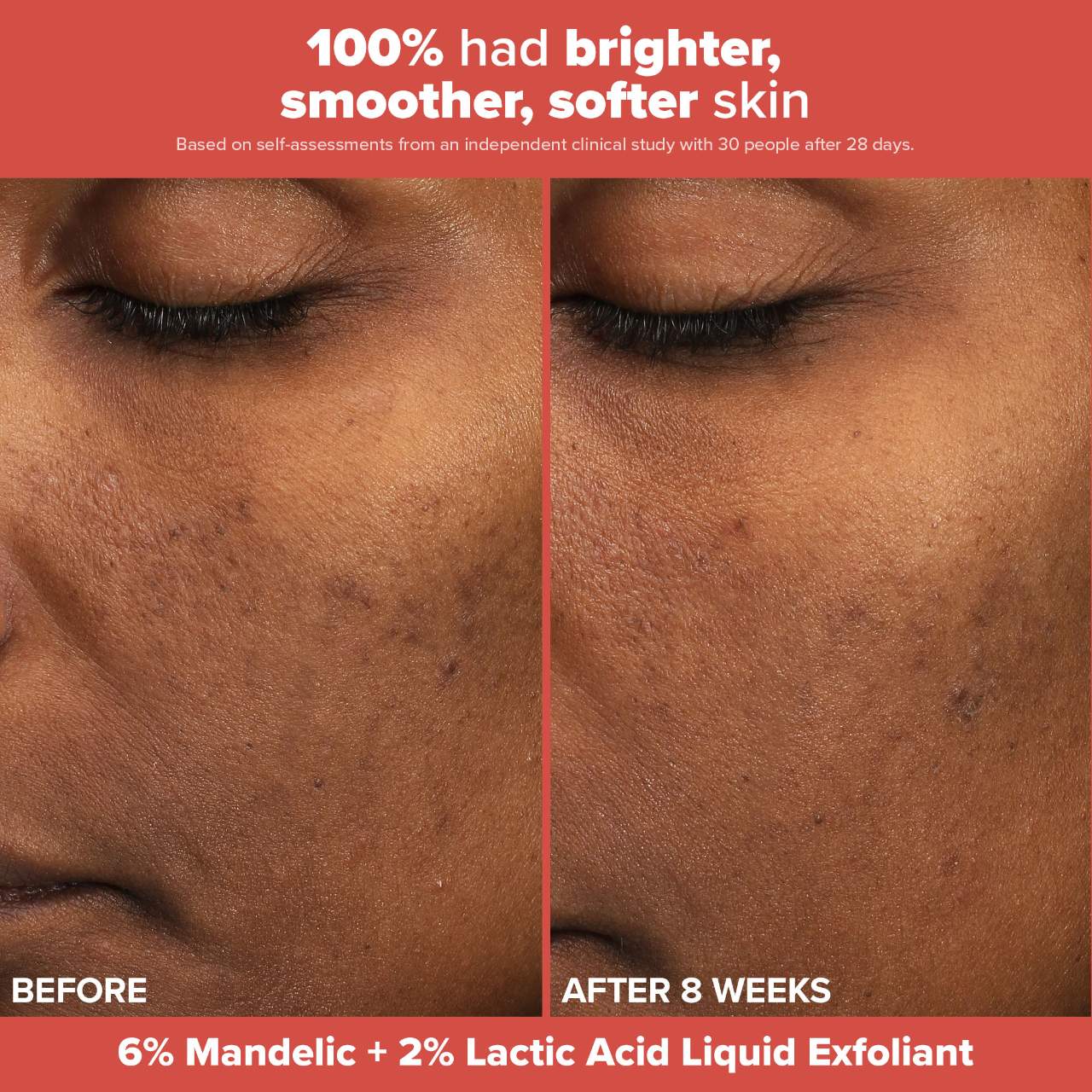 Paula's Choice 7 Days Of Glow Advent Calendar With 2% Bha, Peptide ...